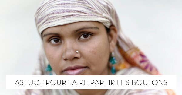 Astuce pour faire partir les boutons - Le blog StarOfService